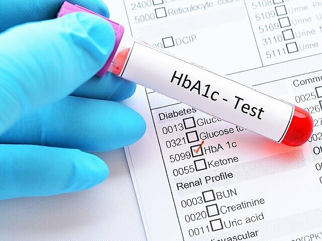 HbA1c Bedeutung - Alles zum Langzeitblutzuckerwert